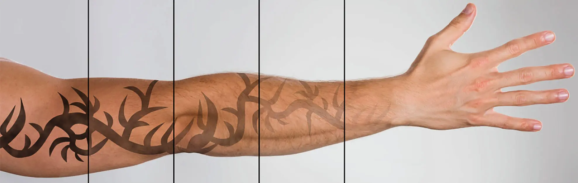 Dermatologue à Embourg, Liège | Traitements laser | I. Uhoda